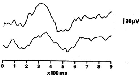 Recording Of Response To Olfactory Stimulus Presentation In Control 18 Download Scientific Diagram