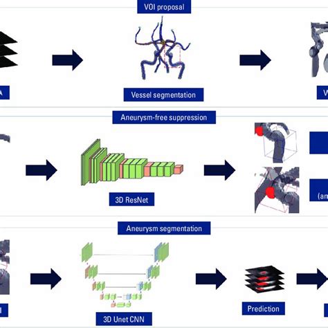 Pipeline Of The Model A After Automated Vessel Segmentation And 3d Download Scientific