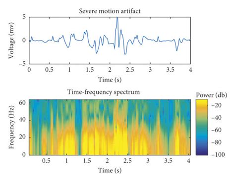 The Time Frequency Spectrum For Five Types Of Dynamic Ecg Signals Download Scientific Diagram