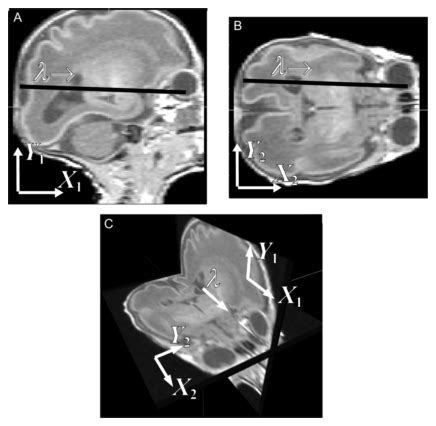 Mri