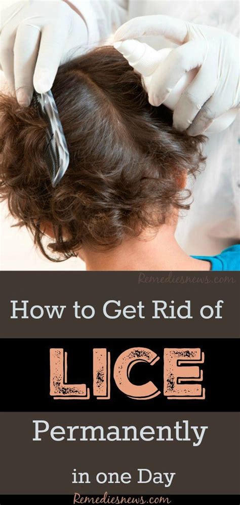 7 Effective Home Remedies To Get Rid Of Lice Permanently In One Day