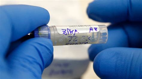 First Sexually Transmitted Case Of Zika Virus Reported In Texas — Rt Usa News