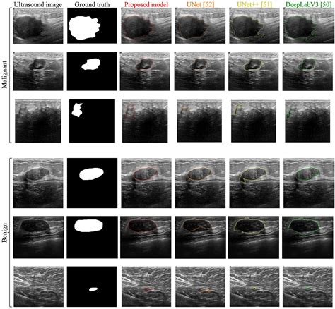 A Multi Task Learning Framework For Automated Segmentation And