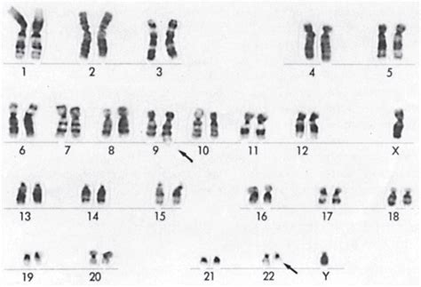 An Introduction To Human Genetics Basicmedical Key