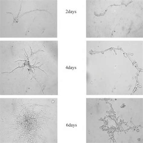Seed Culture Profile Of C Acremonium M25 In The Shake Flask
