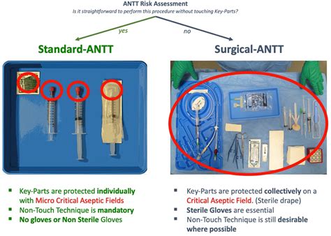 ANTT Procedures Settings
