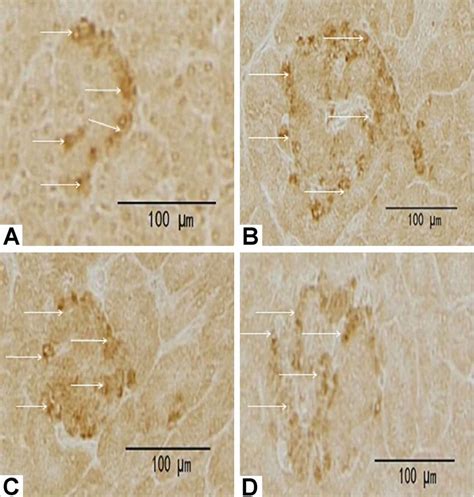 Effects Of Exogenous Ghrelin On The Distribution Of Somatostatin