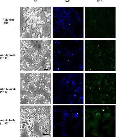 Indirect Immunofluorescence Assay For The Recognition Of Native Download Scientific Diagram