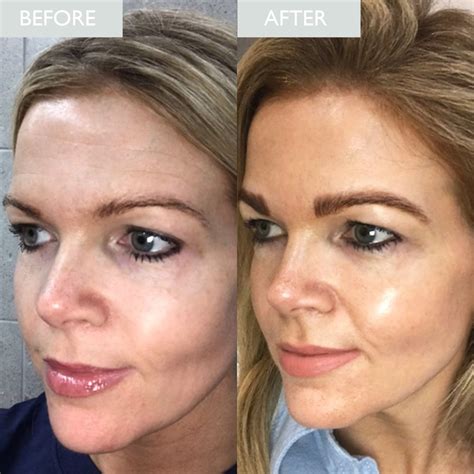 Skincare Samples For Dry Or Sensitive Skin Skinician