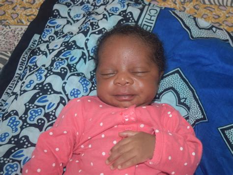 Isaya From Tanzania Raised 890 To Fund Clubfoot Treatment Watsi