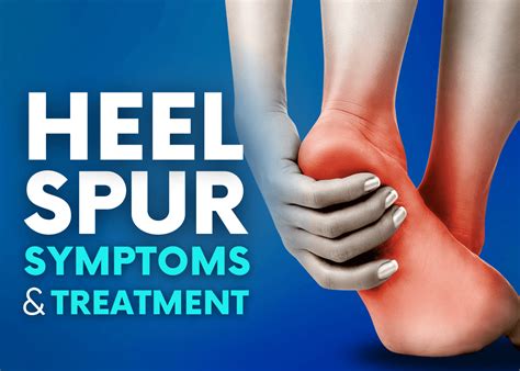 Heel Spur Exercises 11 Exercises You Can Do At Home Turanandturan