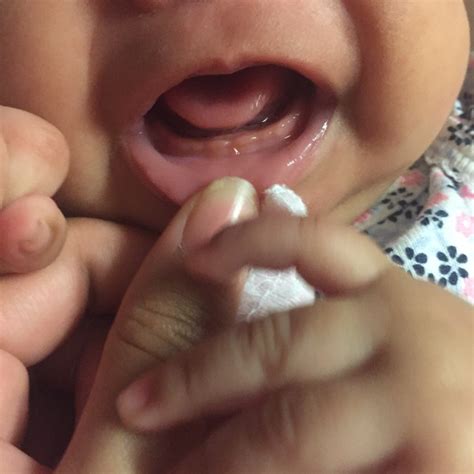 2 Month Old Teething Online