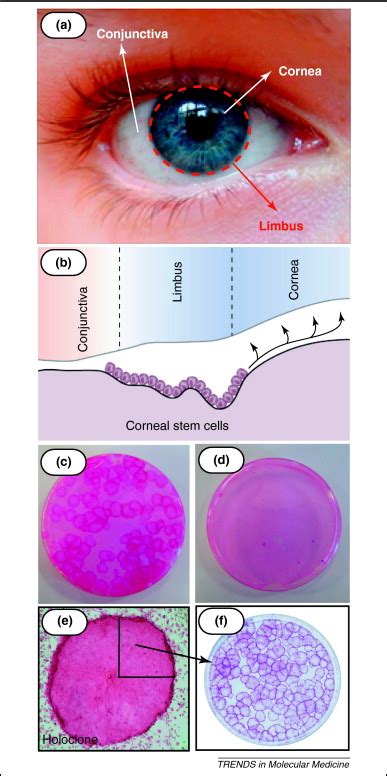 Vision From The Right Stem Trends In Molecular Medicine