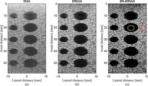 Double Stage Delay Multiply And Sum Beamforming Algorithm Applied To