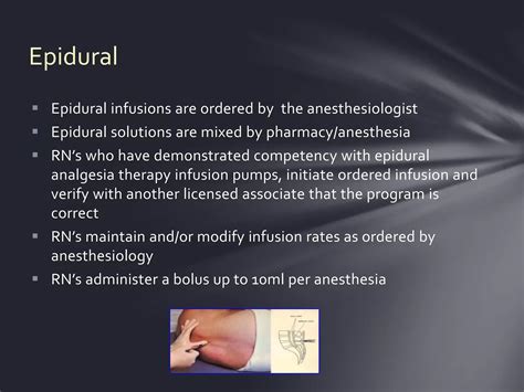 Epidural Pptx
