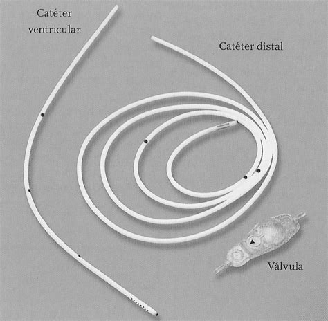 Dr Aramis Pedro Teixeira Hidrocefalia