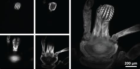 Neurons Under Microscope
