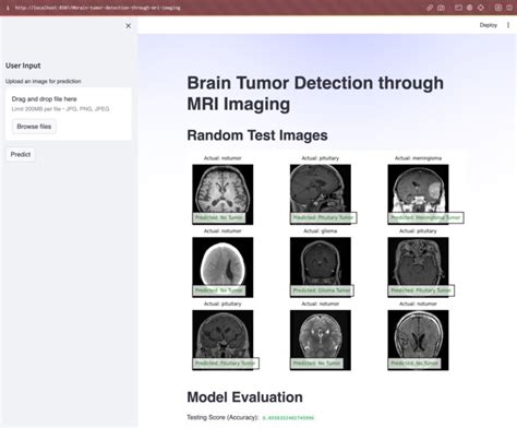 Brain Tumor Classification Model Devpost