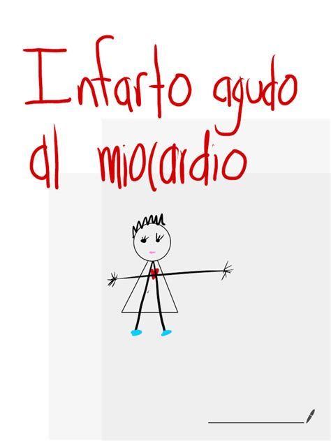 Infarto Agudo Al Miocardio 3 Pdf Infarto De Miocardio Angiología