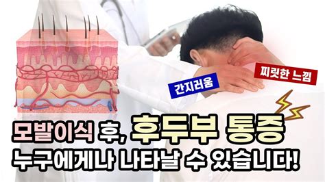 비절개 모발이식 이후 후두부 통증 간지럽고 찌릿해요 부작용 일까요 🥲 Youtube