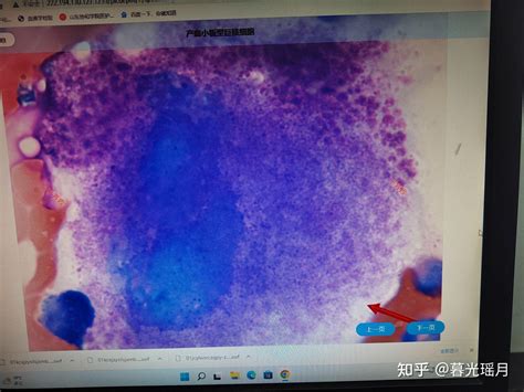临床血液学检验技术 正常细胞形态学观察实验报告 红蓝铅笔 知乎