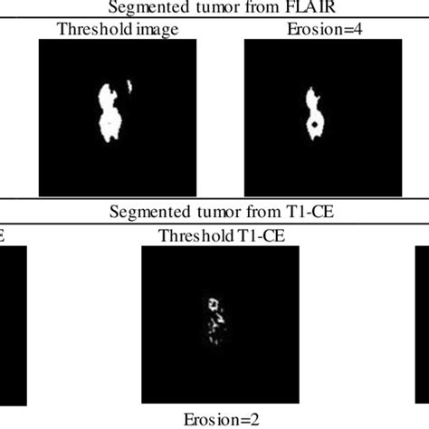Proposed Brain Tumor Segmentation Algorithm Download Scientific Diagram