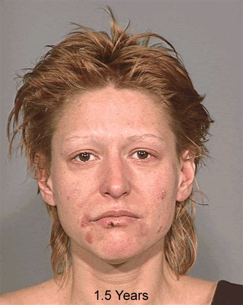 Photos Before And After Mugshots Of Meth Users Wjla