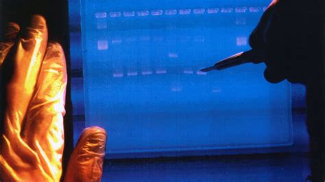 Tecnología Crispr Una Esperanza Para Seis Pacientes Con Una Enfermedad