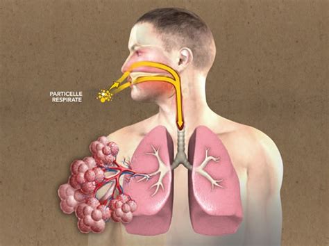 Che Cosè La Tubercolosi Come Si Trasmette E Quali Sono Le Terapie