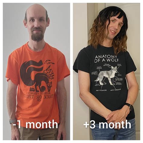 1 Month 3 Month Hrt Mtf R Transtimelines