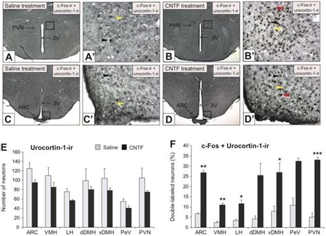 Representative Photomicrographs Are Shown Of Neurons Co Expressing