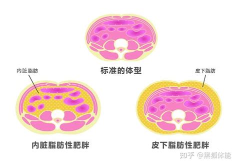 皮下脂肪 VS 内脏脂肪 知乎