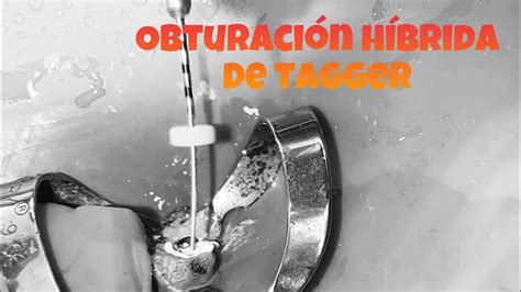 Técnica Híbrida De Tagger Termomecánica Canino Superior Youtube