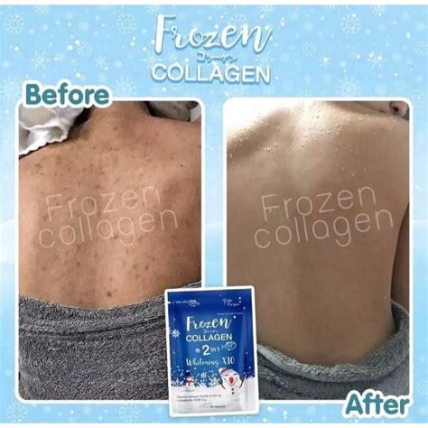 Jual Frozen Collagen 2 In 1 Whitening X10 Original Thailand 100