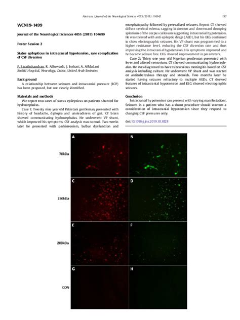 Pdf Status Epilepticus In Intracranial Hypotension Rare Complication