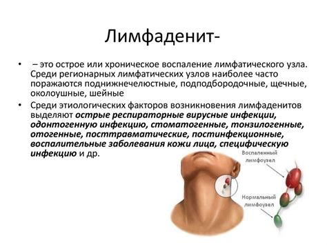 Воспалились лимфоузлы на шее и болит горло лечение