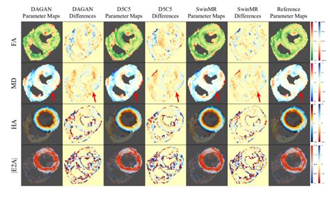 diffusion parameter maps of the reconstruction results af ×4 and the