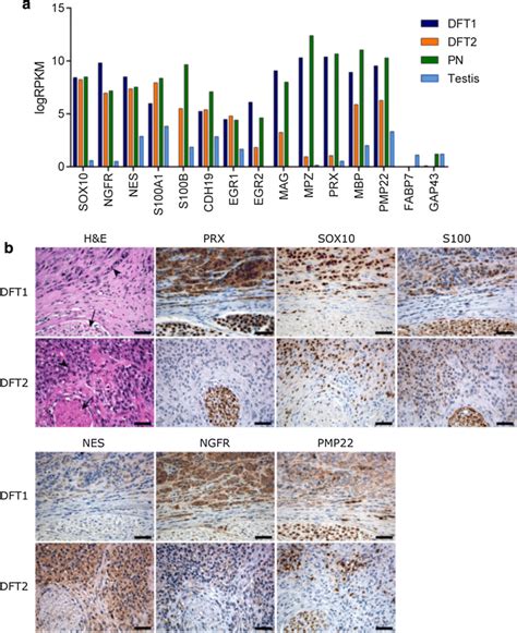 Analysis Of Schwann Cell Marker Expression In Dft1 And Dft2 Tumours A