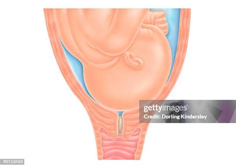 Illustrations Cliparts Dessins Animés Et Icônes De Cervix Labour