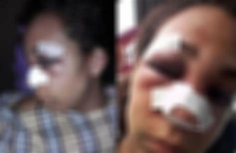 Mulher é agredida pelo ex marido martelo na frente da filha no Rio