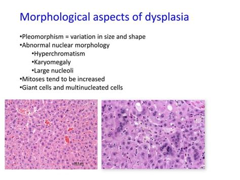 Carcinogenesis World Toxicologic Pathology Congress Ppt