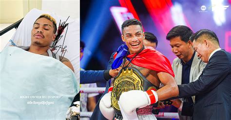 កីឡាករប្រដាល់ ចាន់ ប៊ុនហឿន ត្រូវរថយន្ដបុកពីក្រោយពេលកំពុងរត់ហាត់តាមផ្លូវ