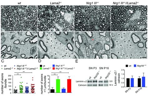 Partial Loss Of Neuregulin 1 Type III Nrg1III Does Not Impair Axonal