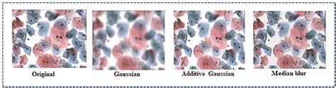 Figure From Cervical Cells Nucleus Segmentation Through An Improved