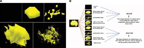 Figure 3 From The Modified Shrinkage Classification Modes Could Help To