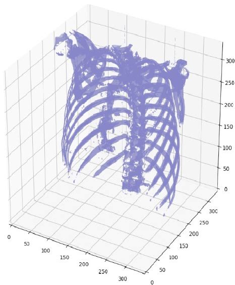 Figure 4 From Malignant Lung Nodule Detection Using Deep Learning