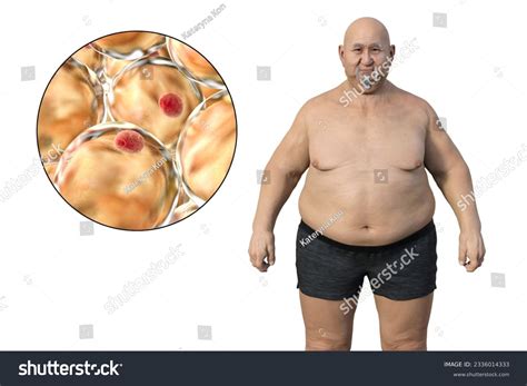 The Role Of Lipid Images Stock Photos Vectors Shutterstock