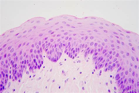 Stratified Squamous Epithelium Non Keratinized Esophagus Histology My