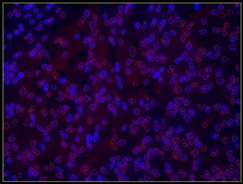 Cell Detection In Qupath Not Working Across Samples Image Analysis Image Sc Forum