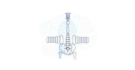 The Truth About Ultrasonic Spine Surgery 2023 Review — Atlantic Brain